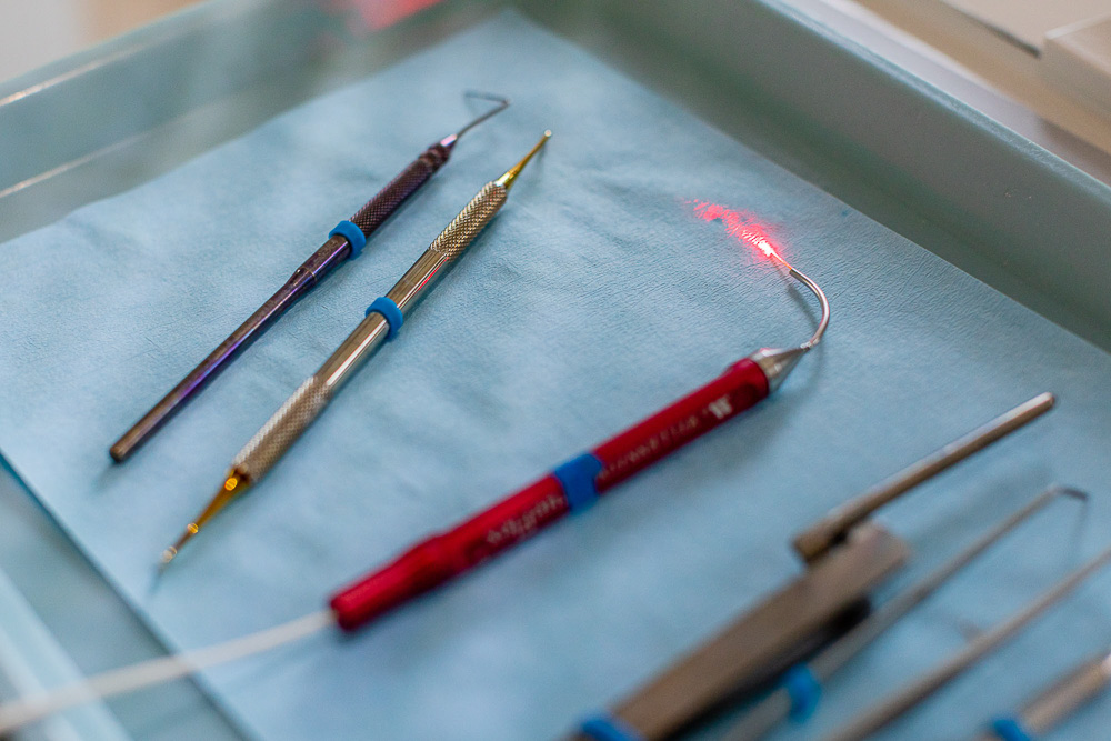 LANAP - painless treatment of gum disease - LANAP Kompetenzzentrum Schweiz